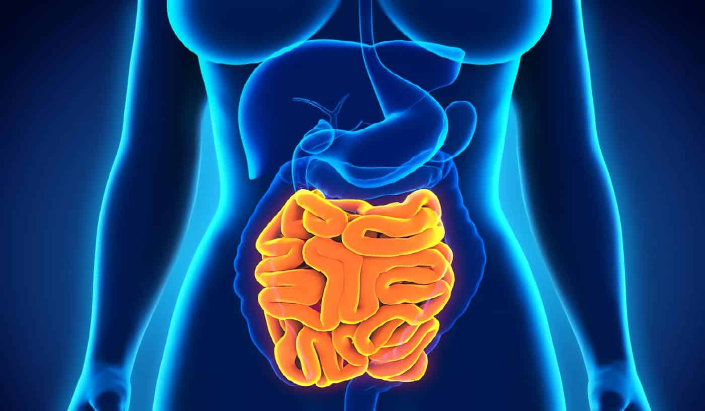 Obstrucción Intestinal a Causa de Íleo Biliar | Sistema Digestivo